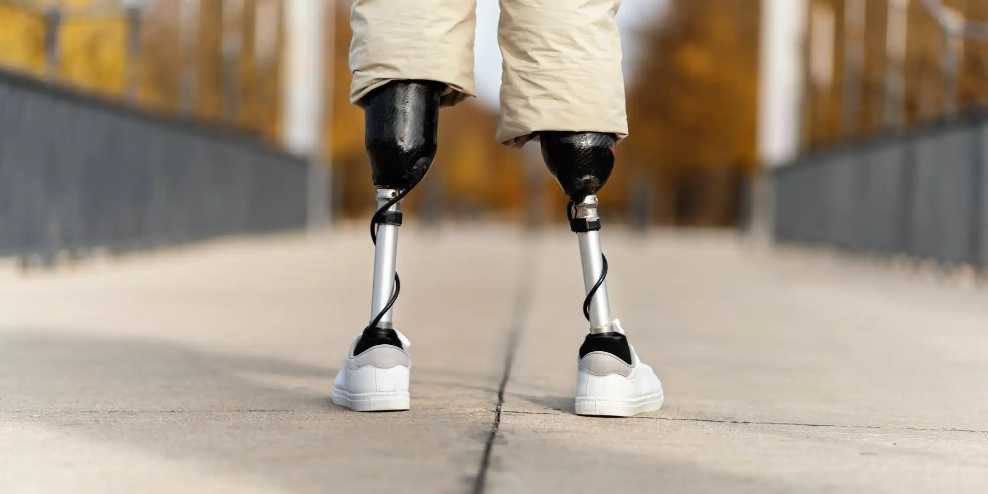 Revolutionizing Prosthetics with EVA Foam: A Leap Forward in Comfort ...